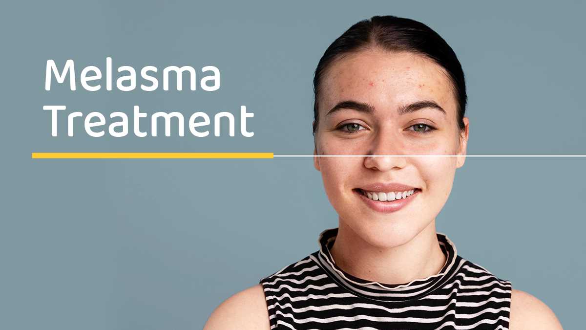 Medkart Pharmacy - Nikol in Nikol, Ahmedabad | Online Medical Stores