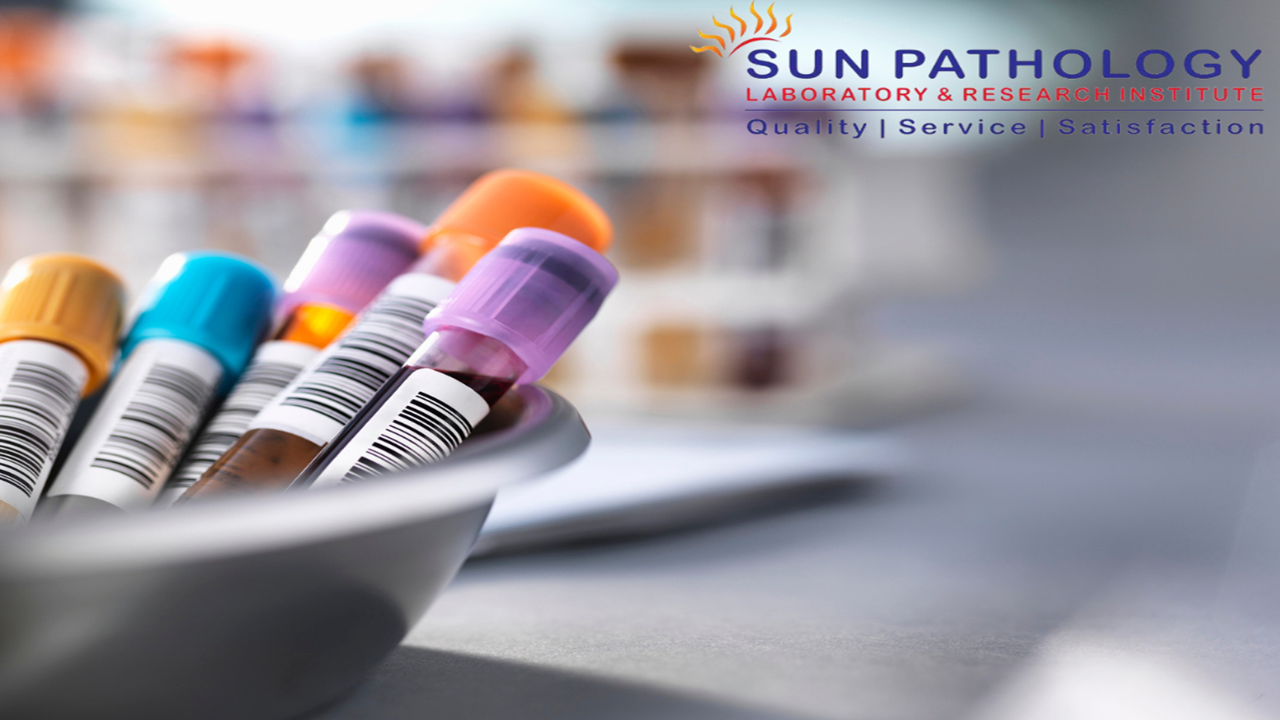 Sun Pathology Laboratory and Research Institute - Best Pathology Lab in ...